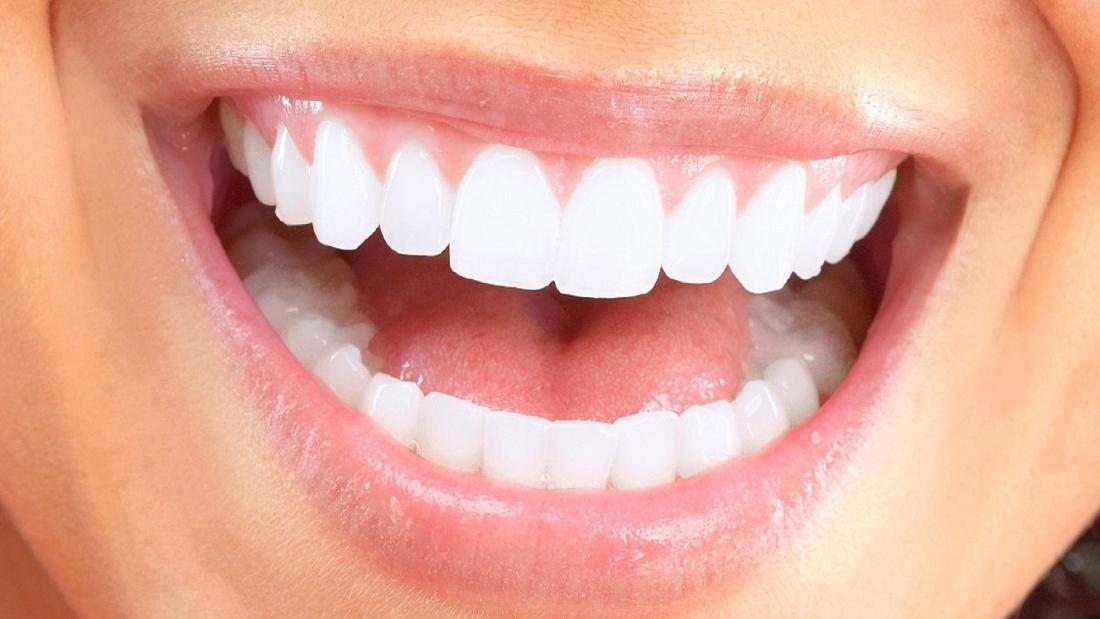 Causes of Stained Teeth | Edmond, OK Cosmetic Dentist Blog